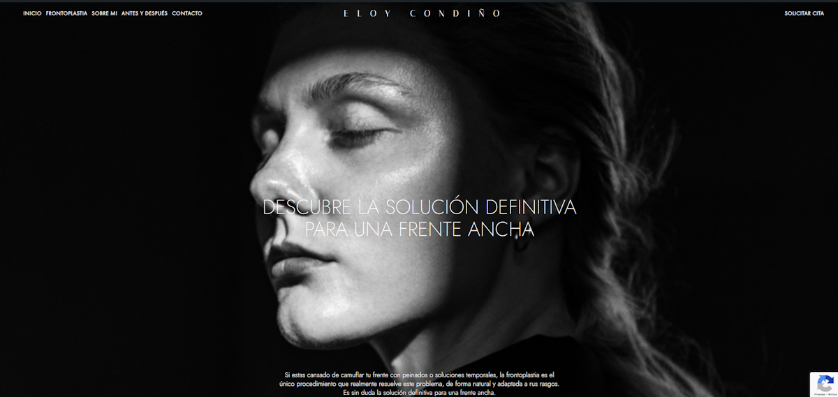 Frontoplastia en Valencia – Cirugía de frente ancha con el Dr. Condiño